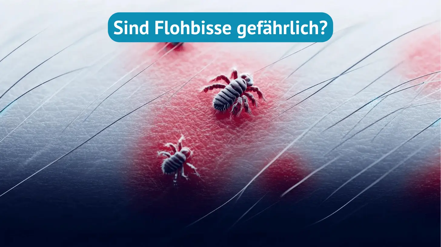 Sind Flohbisse gefährlich? Diese Gesundheitsrisiken drohen